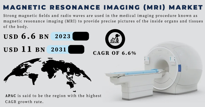 Magnetic Resonance Imaging [MRI] Market Size, Share & Trends